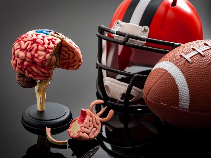 Concussion Therapy | Physiotherapy Service | Summit Physio